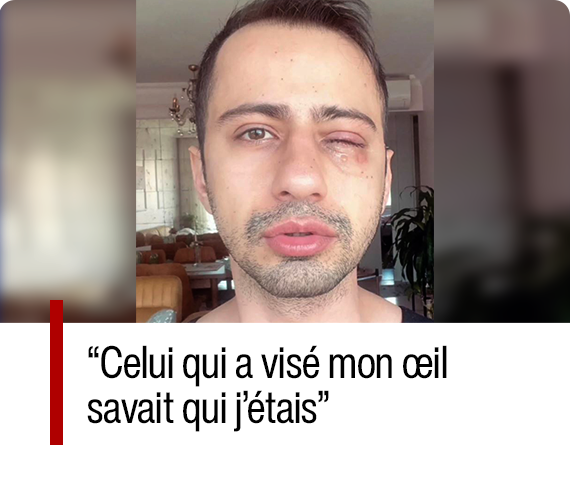 Mort de Mahsa Amini : révolte et destins brisés en Iran - France 24